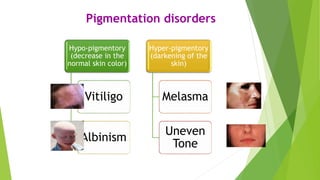 Skin Lightening.pptx