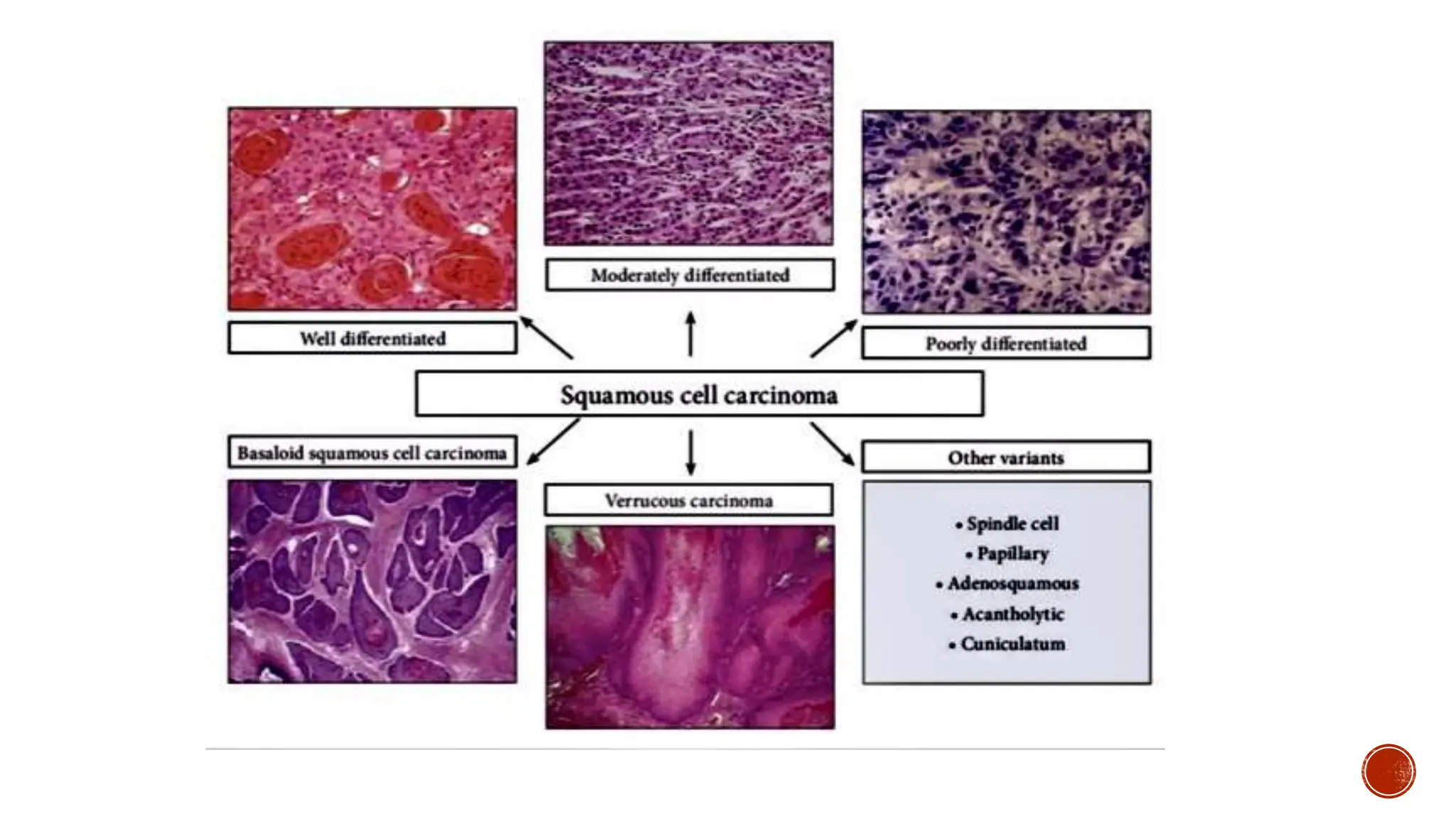 Different types of skin tumours and their management | PPT