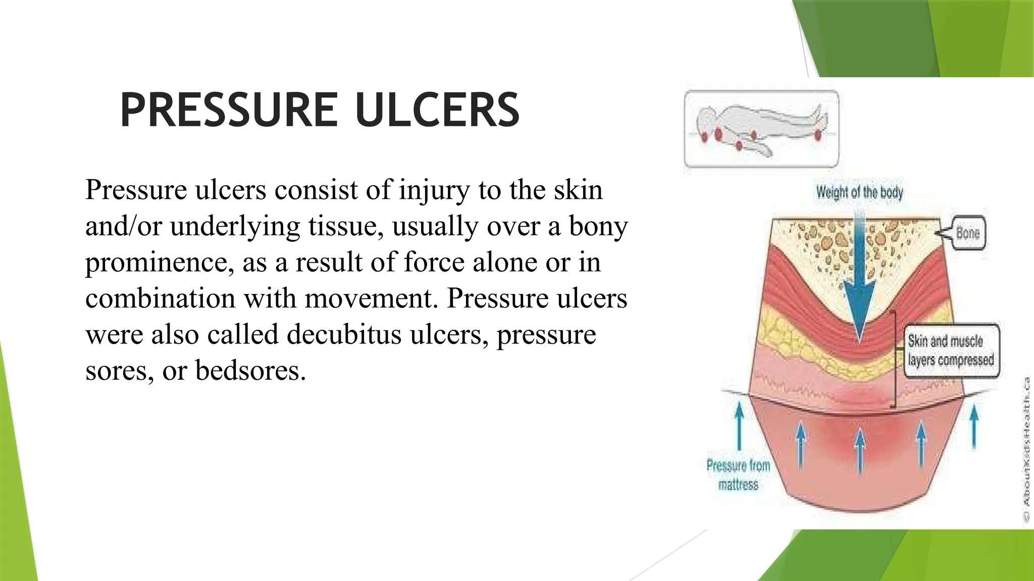Skin Management, pressure ulcers, FON.pptx