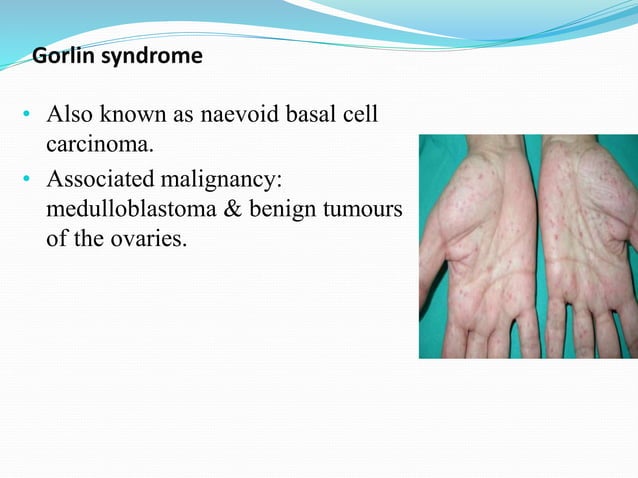 Skin manifestation of internal malignancy | PPTX | Skin and Dermatology ...