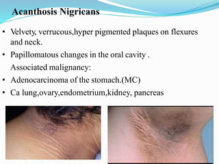 Skin manifestation of internal malignancy | PPTX