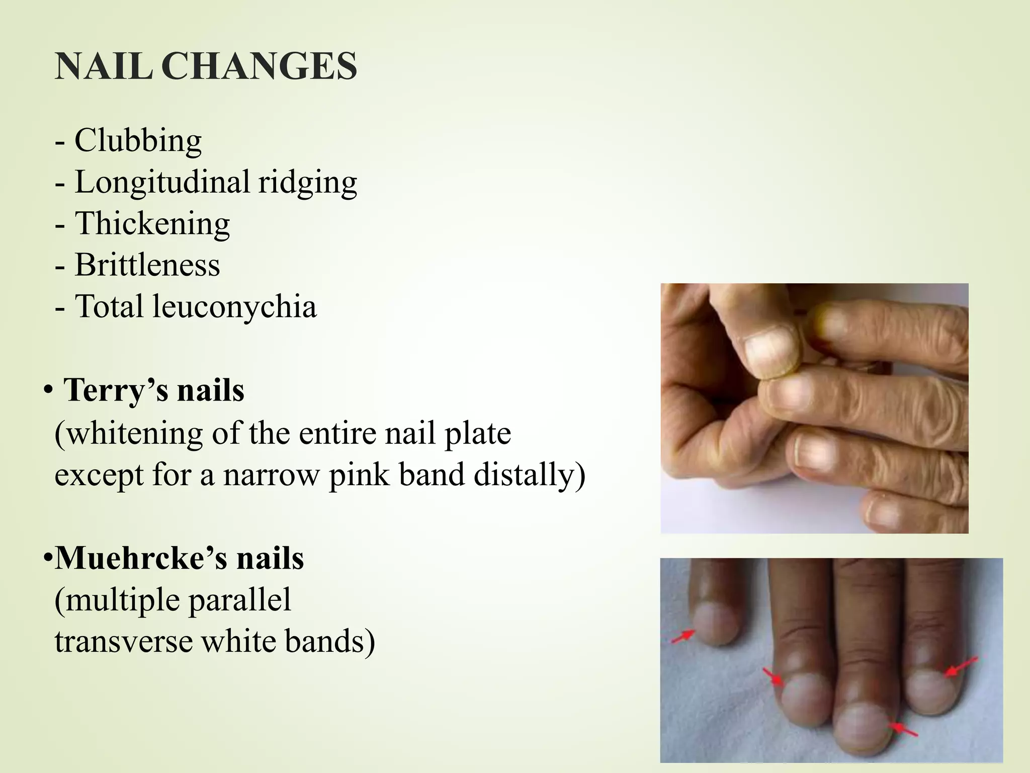 skin manifestation liver disease.pptx