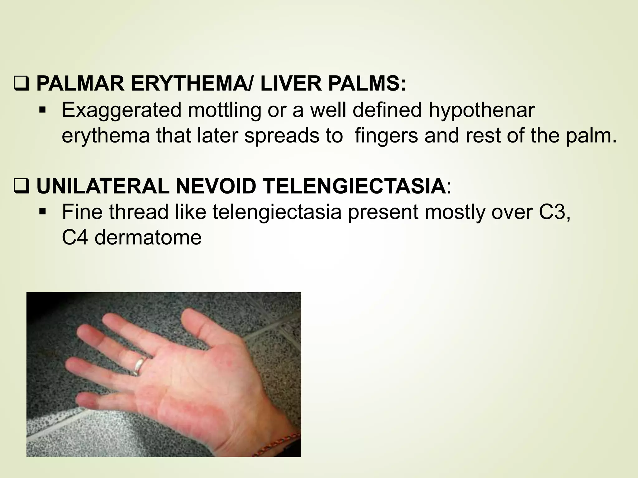 skin manifestation liver disease.pptx