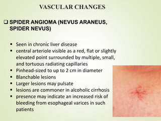 skin manifestation liver disease.pptx