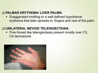 skin manifestation liver disease.pptx