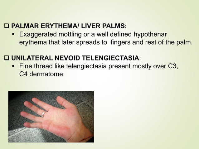 skin manifestation liver disease.pptx | Blood Disorders | Diseases and ...