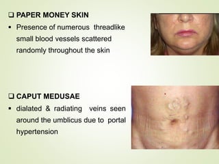 skin manifestation liver disease.pptx