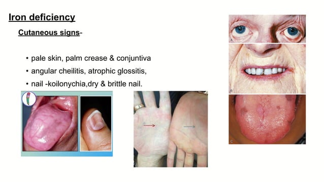skin manifestation of internal disease.pptx (2).pdf
