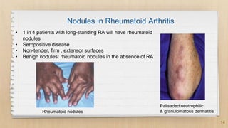 Skin manifestations in rheumatic diseases | PPTX