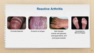 Skin manifestations in rheumatic diseases | PPT