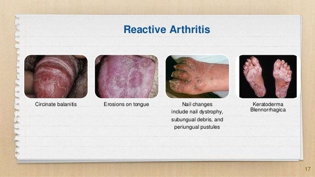 Skin manifestations in rheumatic diseases