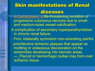 Skin Manifestations Of Systemic Diseases | PPT