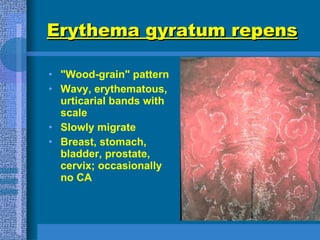 Skin Manifestations Of Systemic Diseases | PPT
