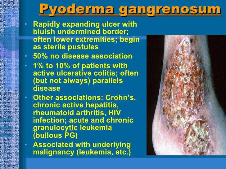 Skin Manifestations Of Systemic Diseases