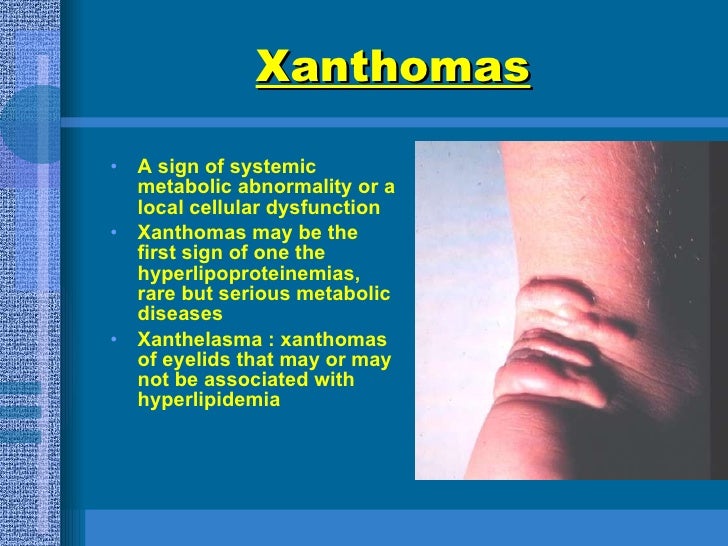 Skin Manifestations Of Systemic Diseases