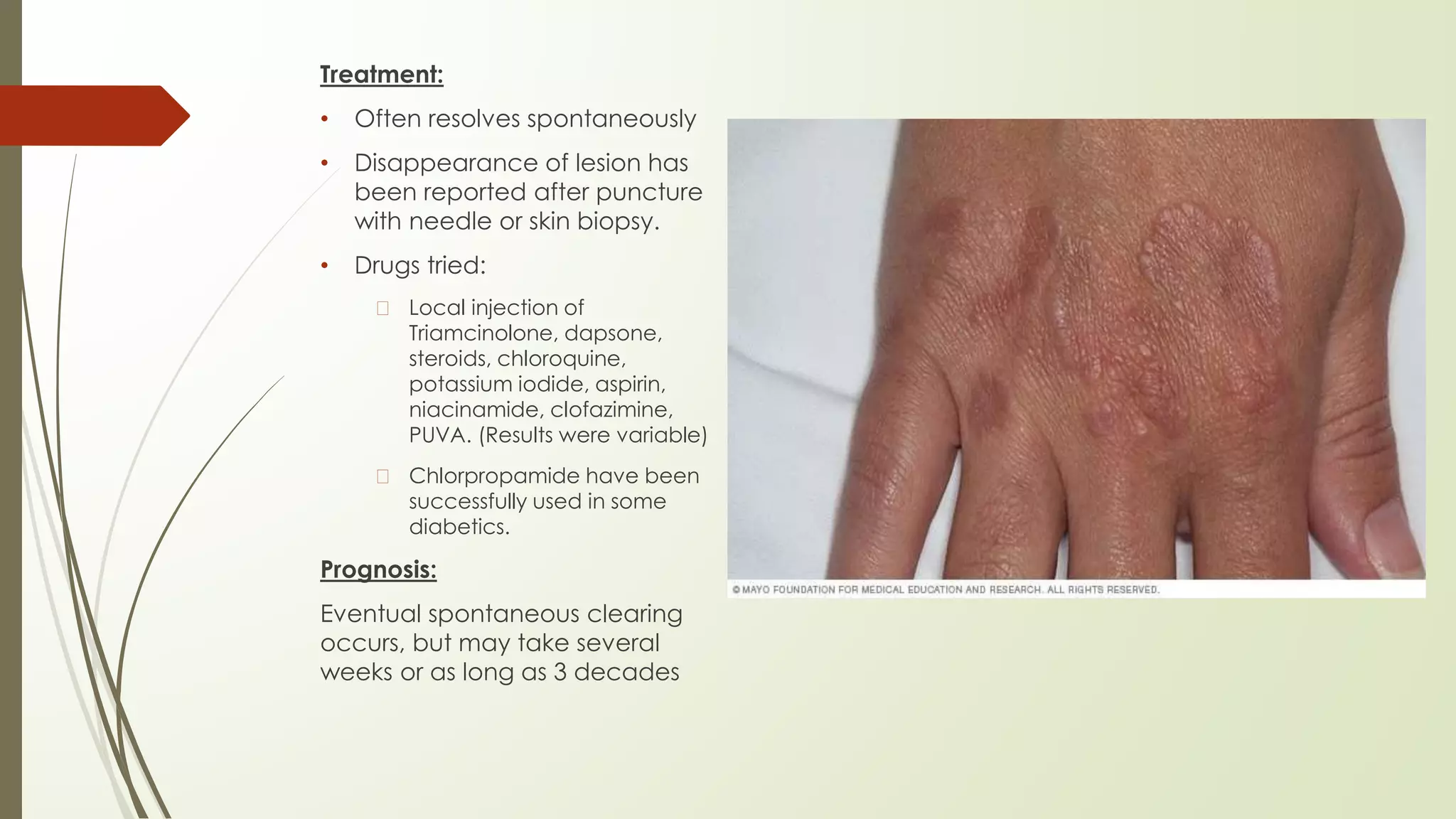 Skin Manifestation of Diabetes | PPTX