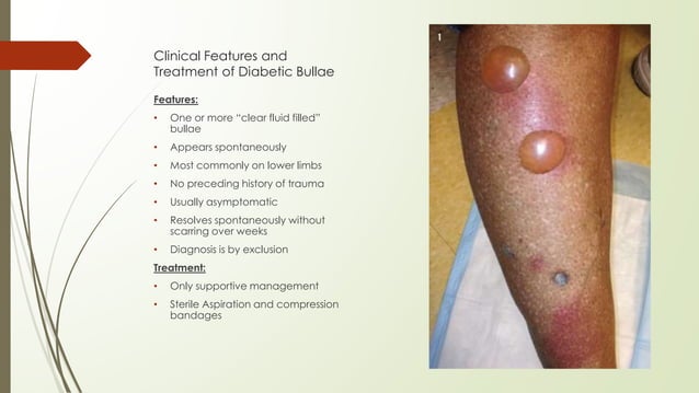 Skin Manifestation of Diabetes | PPTX