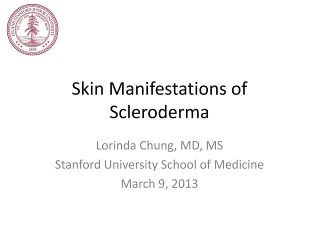 Skin Manifestations of Scleroderma, by Dr. Lorinda Chung MD | PPTX ...