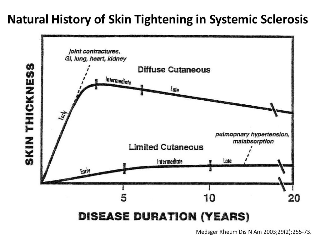 Skin Manifestations of Scleroderma, by Dr. Lorinda Chung MD