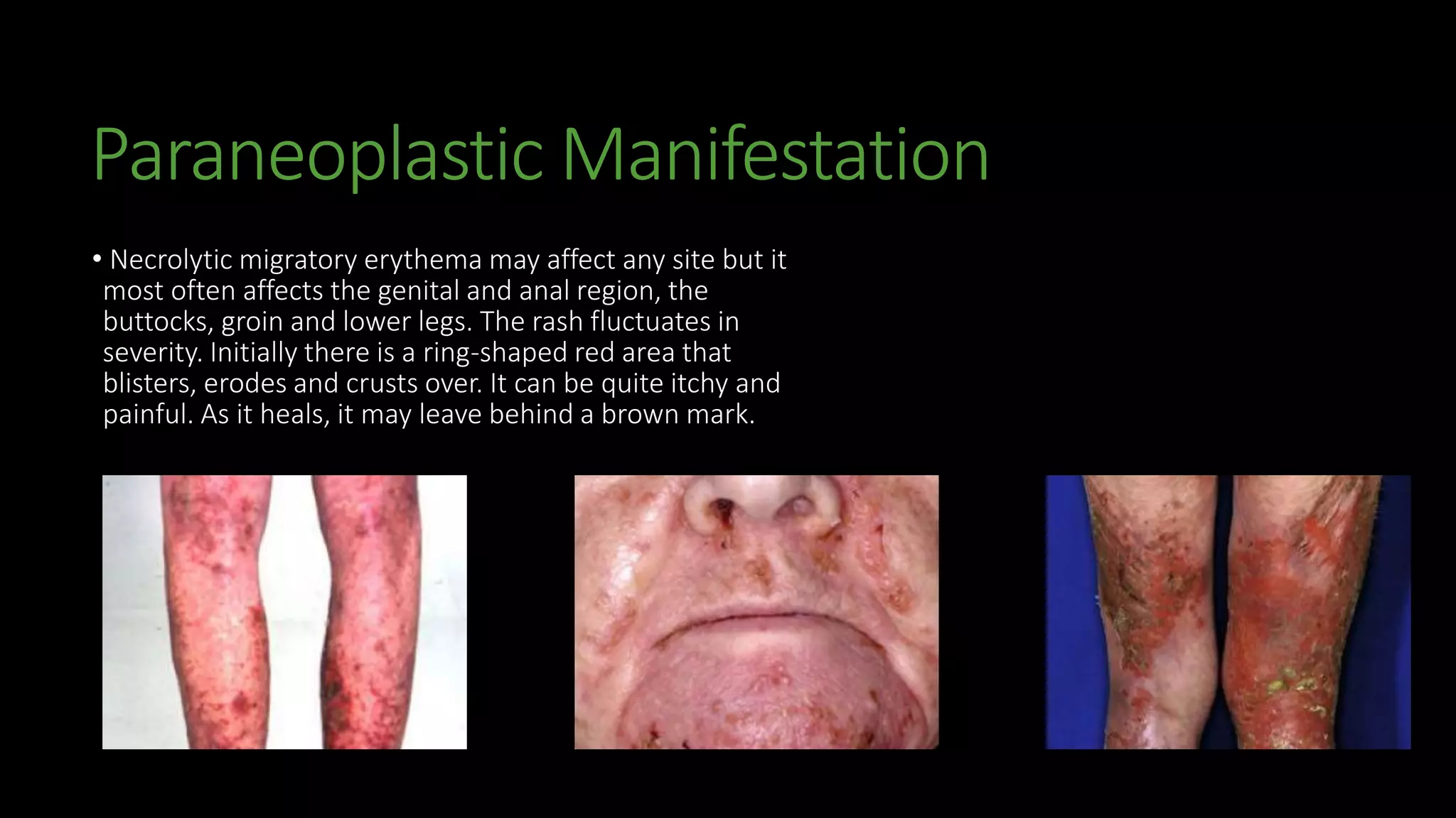 Skin manifestations of systemic diseases | PPTX