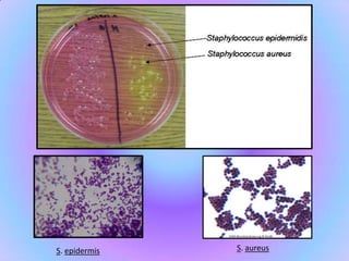 Skin microflora / Normal Flora of Skin | PPTX