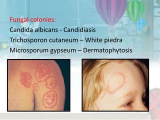 Skin microflora / Normal Flora of Skin | PPTX