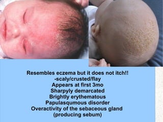 Neonatal paediatric skin diseases | ODP