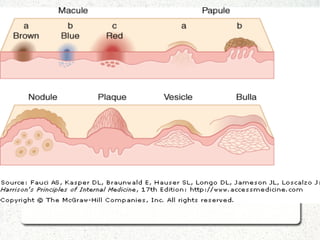 Neonatal paediatric skin diseases | ODP