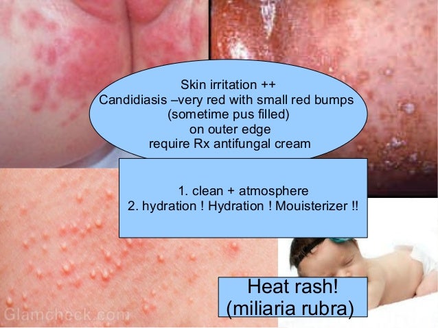 Neonatal paediatric skin diseases