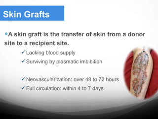 Skinn grafting1 | PPT