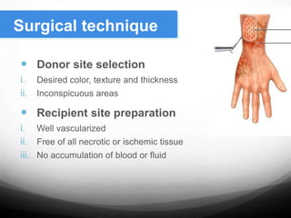 Skinn grafting1 | PPT