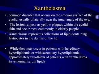Layers of skin of the Eye Lids, Eye Lashes, Eye Lid Pathology, Anatomy ...