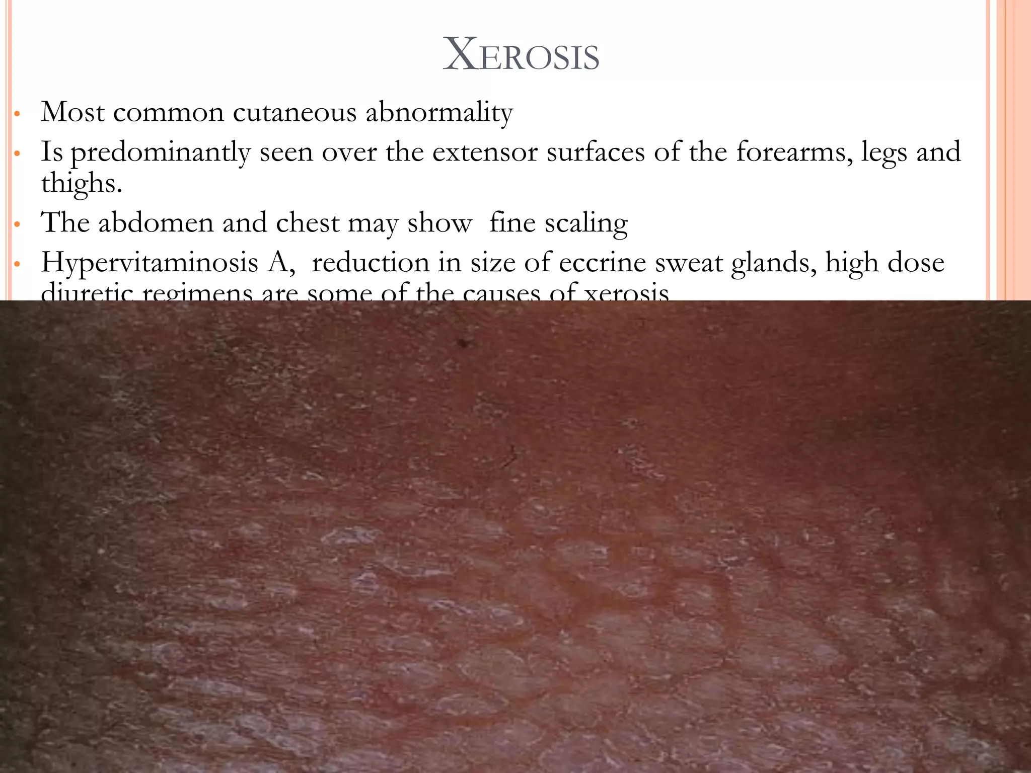 Skin of internal | PDF
