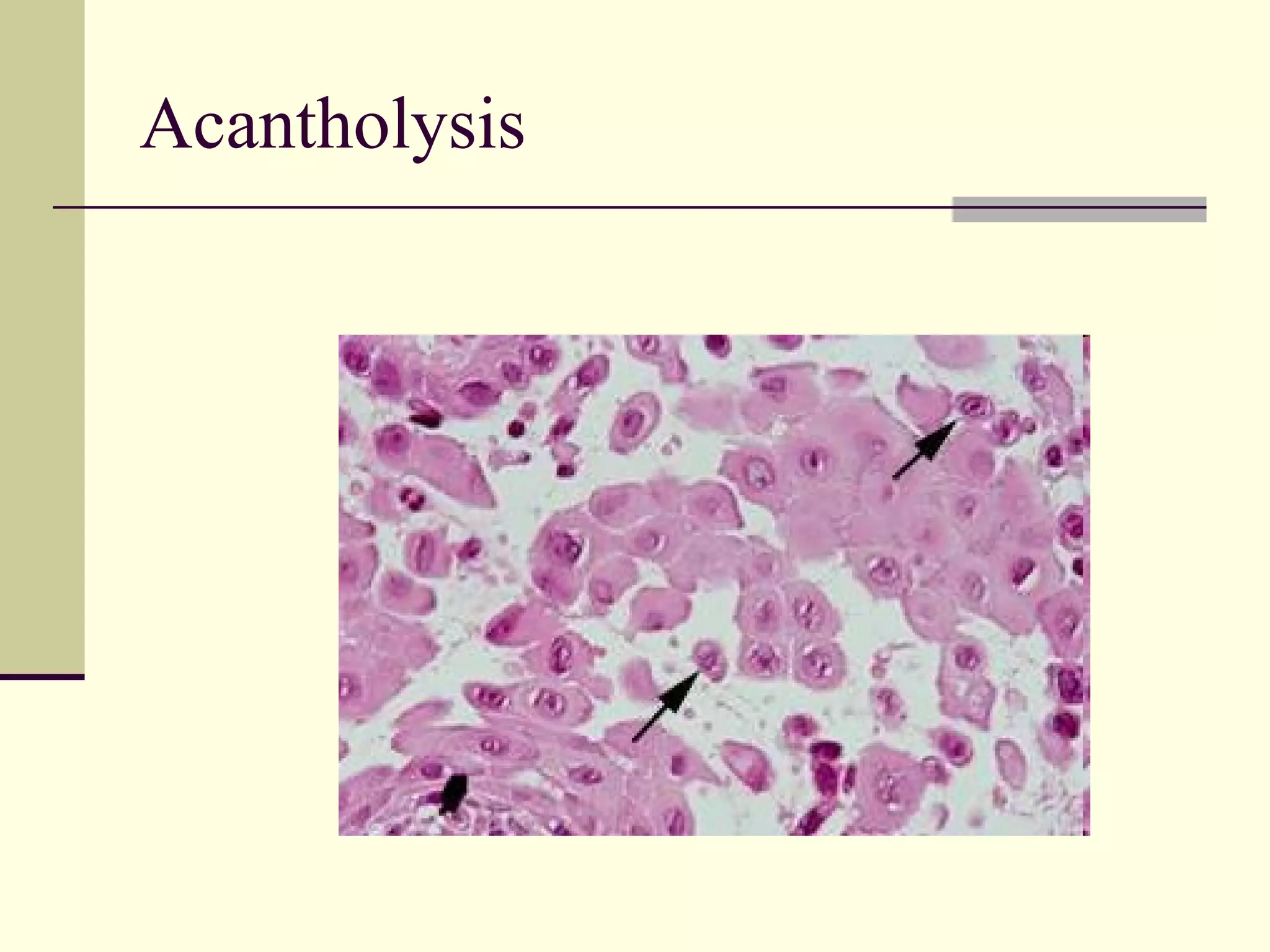 Skin pathology | PPT