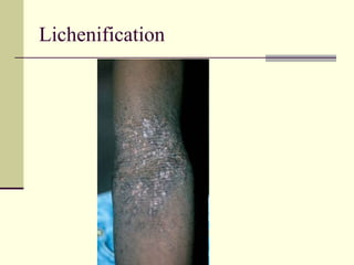 Skin pathology | PPT