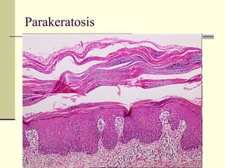 Skin pathology | PPT