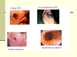 Skin pathology | PPT