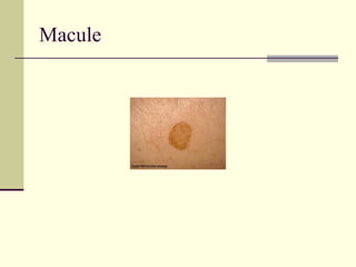 Skin pathology | PPT