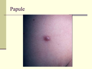 Skin pathology | PPT