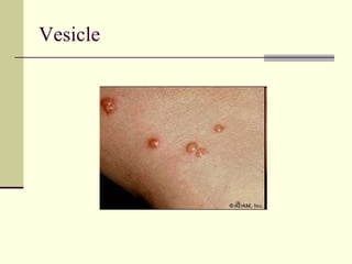 Skin pathology | PPT