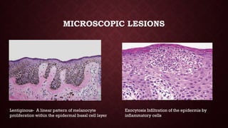Skin pathology ( dermatological lesions) | PPTX
