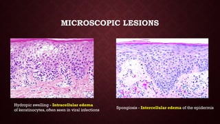 Skin pathology ( dermatological lesions) | PPTX