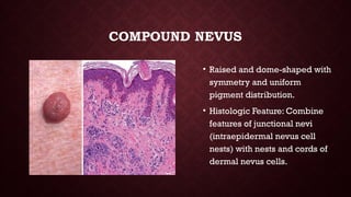 Skin pathology ( dermatological lesions) | PPTX