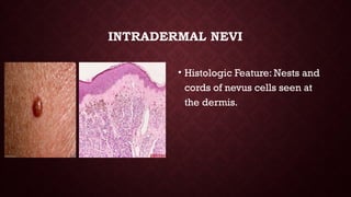 Skin pathology ( dermatological lesions) | PPTX