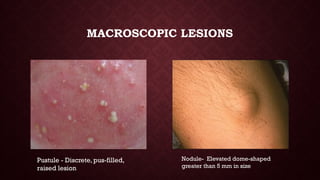 Skin pathology ( dermatological lesions) | PPTX