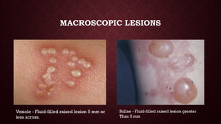 Skin pathology ( dermatological lesions) | PPTX