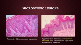 Skin pathology ( dermatological lesions) | PPTX