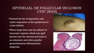 Skin pathology ( dermatological lesions) | PPTX