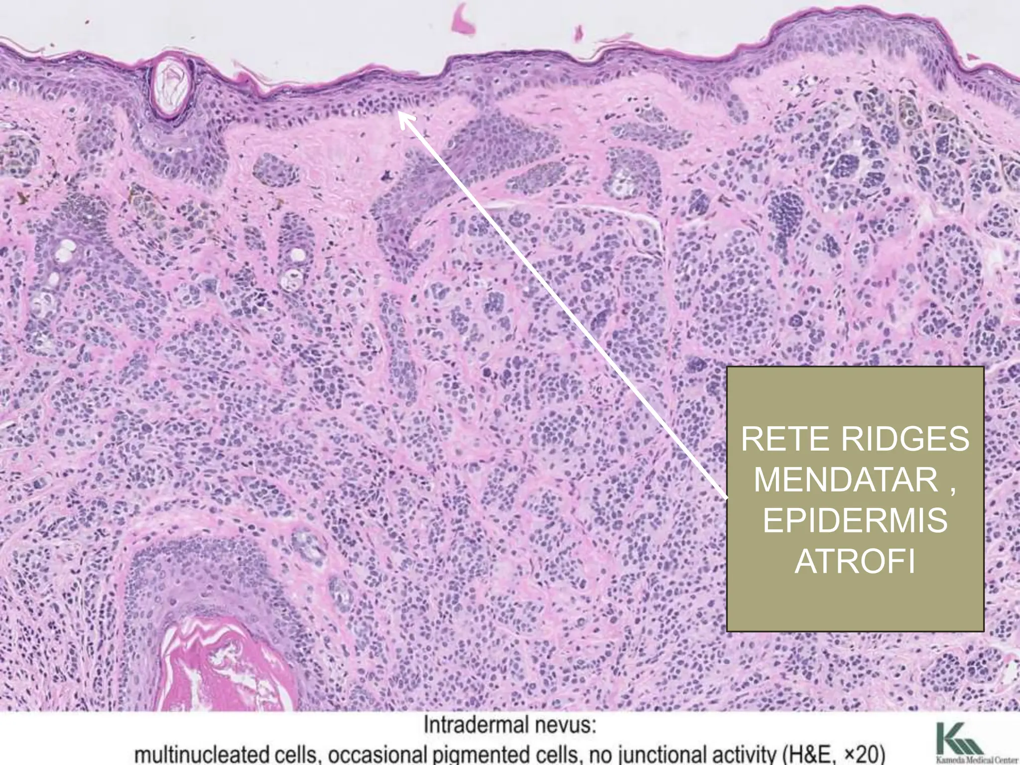 Pathology of the skin skin pathology skin | PPTX