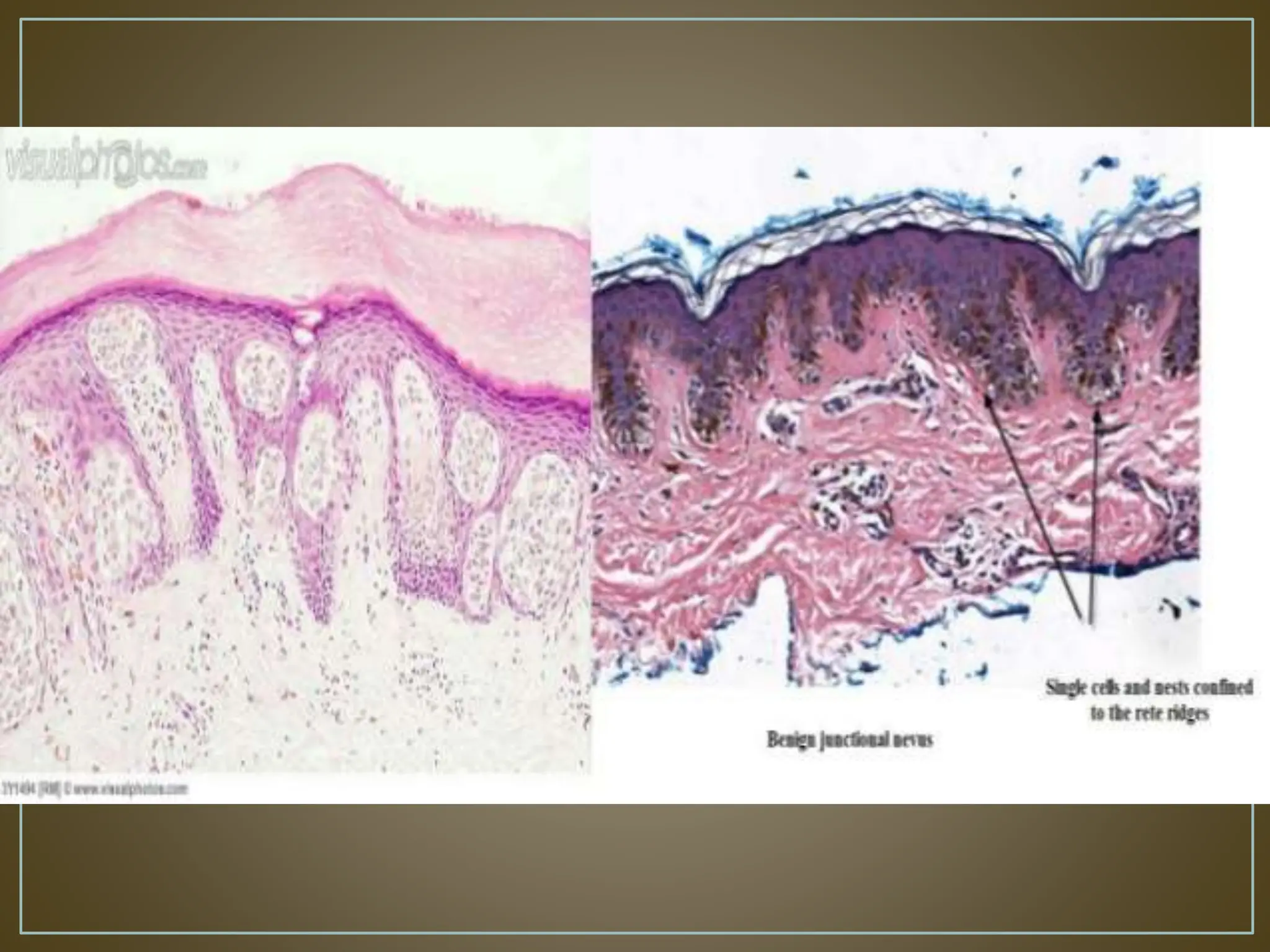 Pathology of the skin skin pathology skin | PPTX